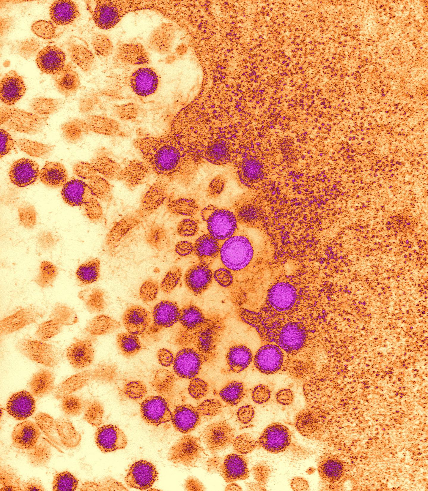 Wasps Captured Viruses in DNA as Part of Evol | EurekAlert!