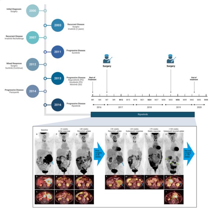 Figure 1 [IMAGE] | EurekAlert! Science News Releases
