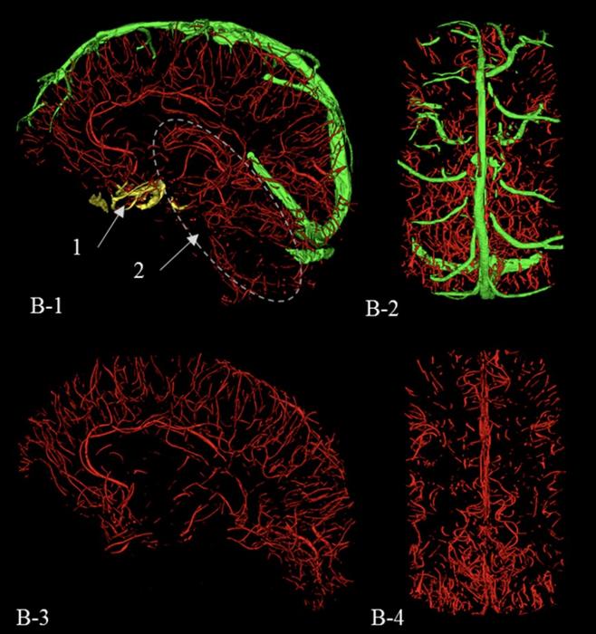 3-D rendering from high resolu [IMAGE] | EurekAlert! Science News Releases