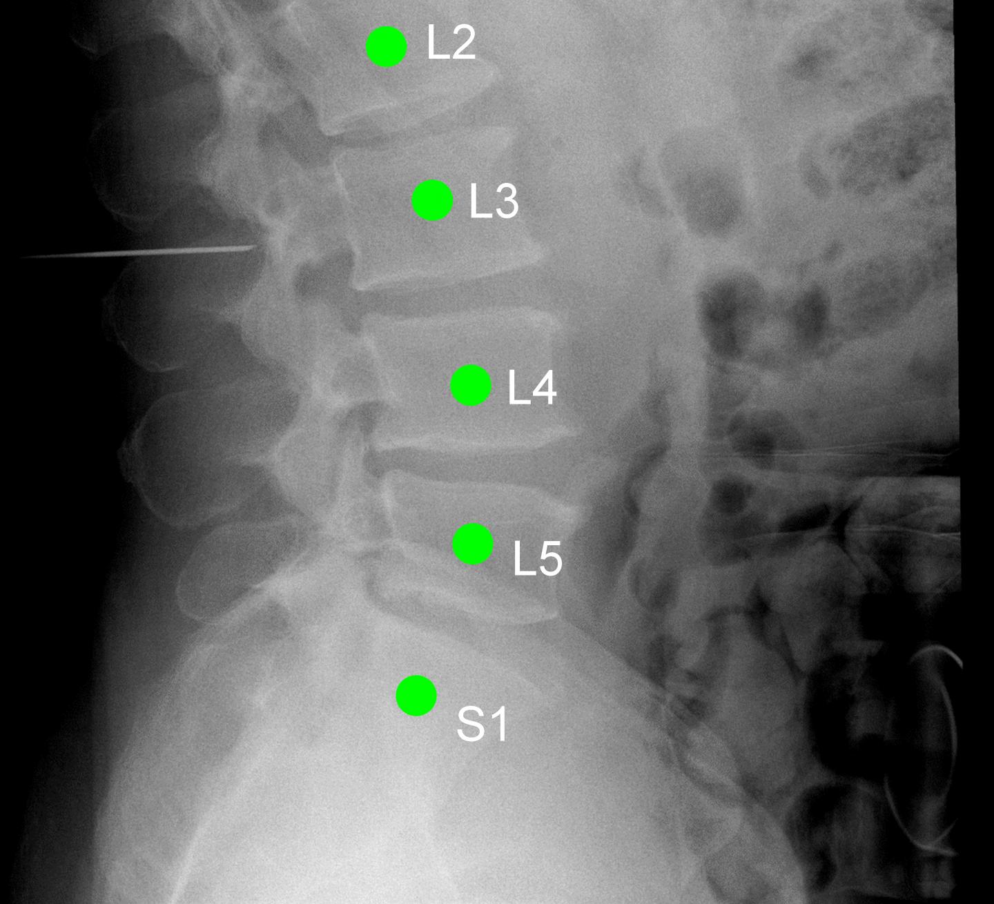 New Software Labels Patients' [IMAGE] | EurekAlert! Science News Releases