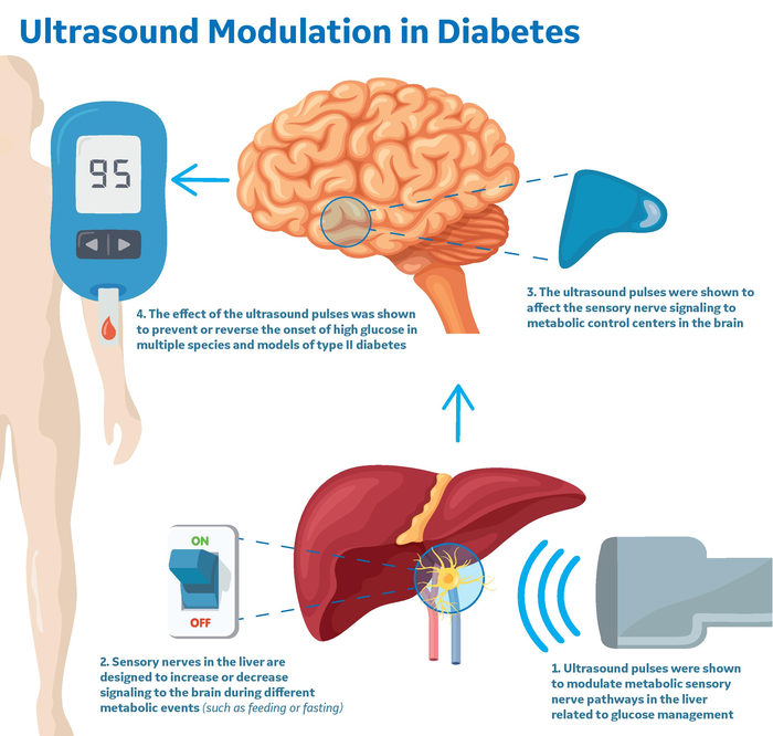Ultrasound Modulation In Diabe [IMAGE] | EurekAlert! Science News Releases
