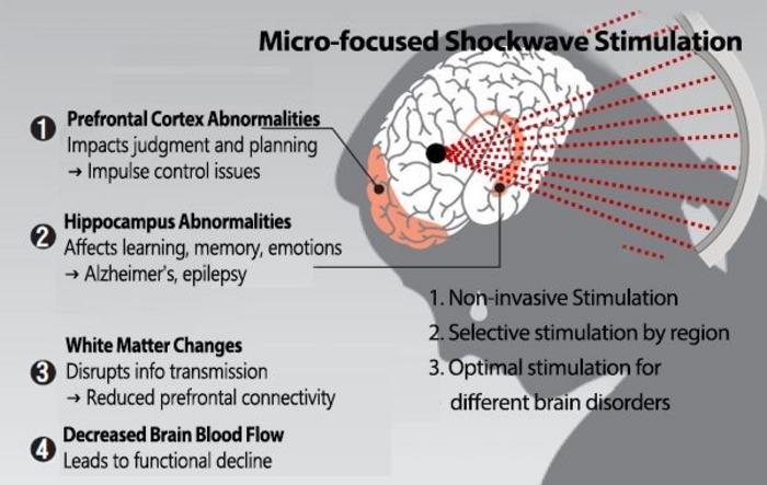 Figure 1. Key Features of Micr [IMAGE] | EurekAlert! Science News Releases