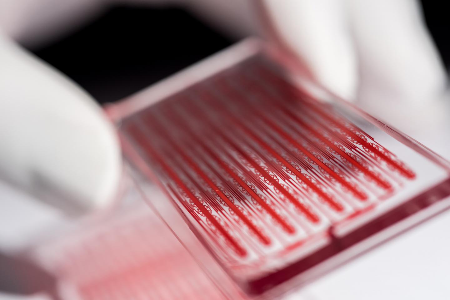 Cancer Chip [IMAGE] | EurekAlert! Science News Releases