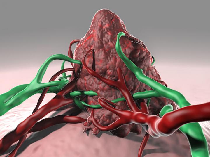 Local -- But Not Systemic -- Chemo Boosts Imm | EurekAlert!