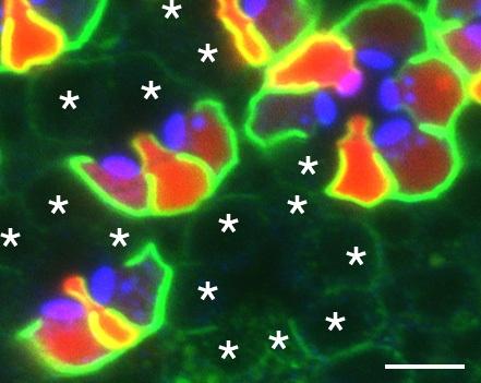 How is the membrane protein folded? | EurekAlert!