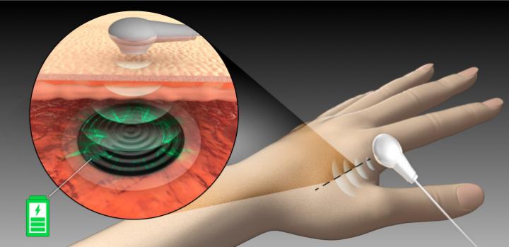 Powering Devices Goes Skin Dee [IMAGE] | EurekAlert! Science News Releases