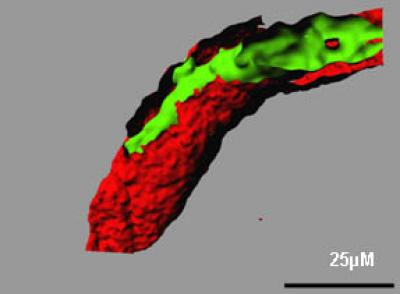 Human Vascular System in Mice [IMAGE] | EurekAlert! Science News Releases