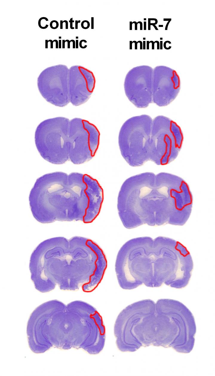 MicroRNA Look Alike Accelerates Post Stroke R EurekAlert 