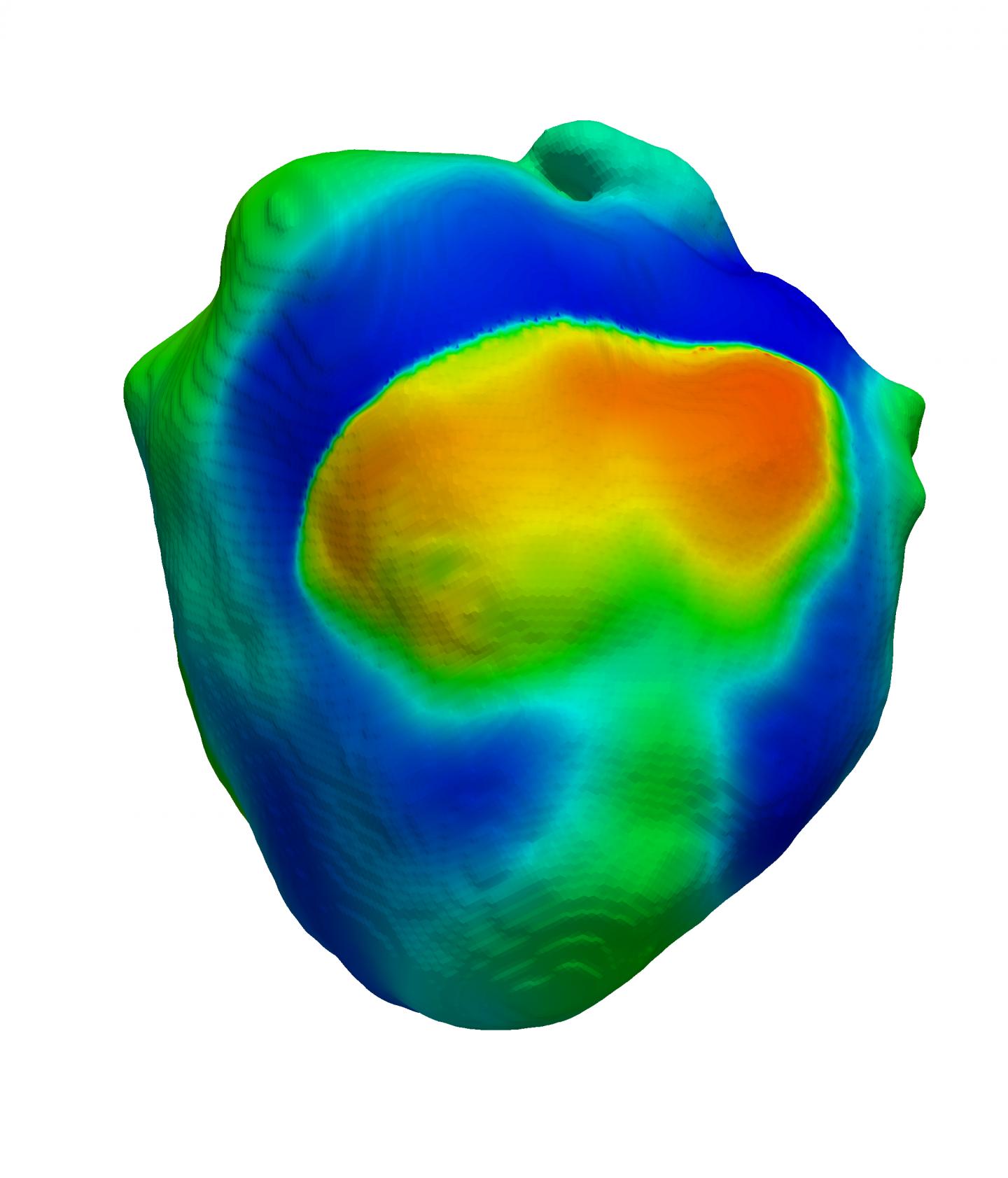 Scientists Use 'Virtual Heart' [IMAGE] | EurekAlert! Science News Releases