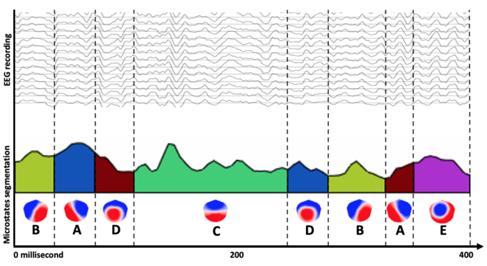 The five basic brain states ex [IMAGE] | EurekAlert! Science News Releases