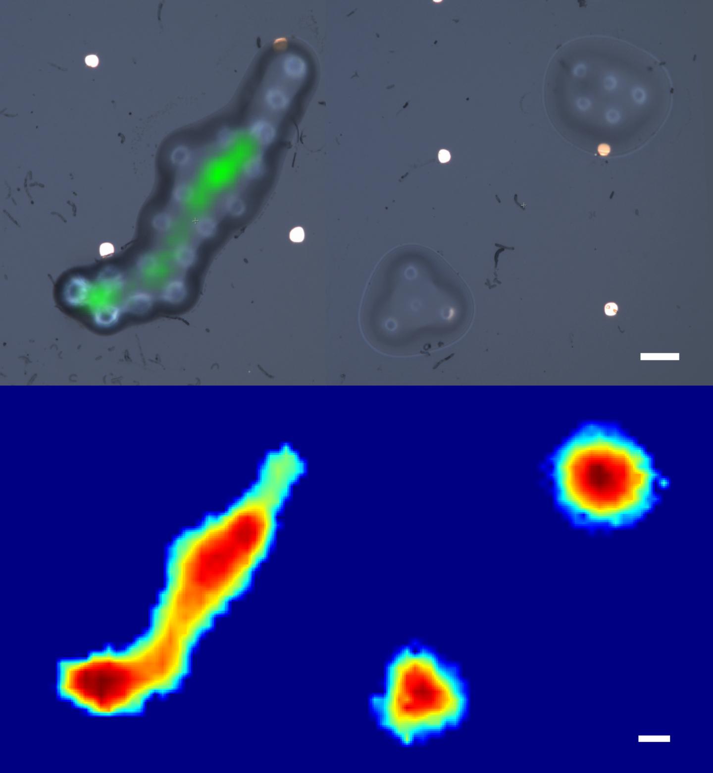 Conventional microscope Vs Pho [IMAGE] | EurekAlert! Science News Releases