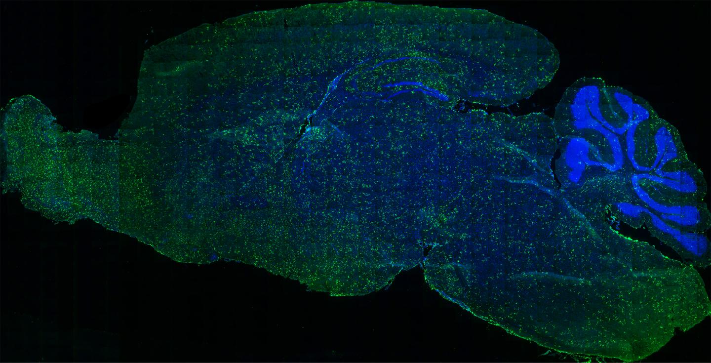 New Stem Cell Delivery Service Helps Freshen | EurekAlert!