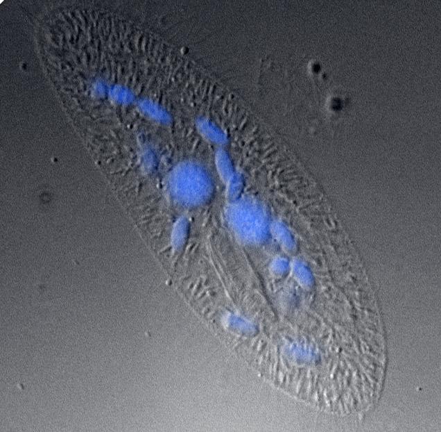 Paramecium [IMAGE] | EurekAlert! Science News Releases