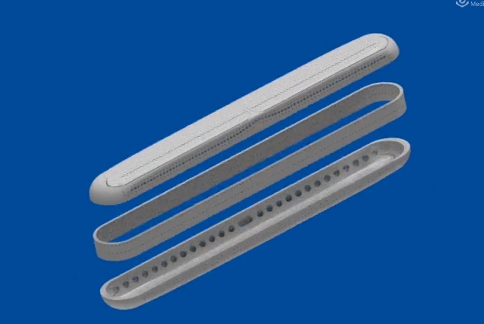 Glass-like shells of diatoms help turn light | EurekAlert!