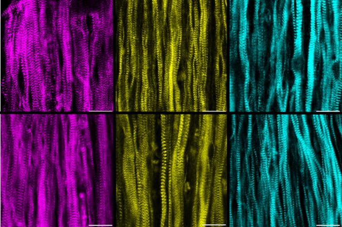 A Closer Look at Muscle [IMAGE] | EurekAlert! Science News Releases