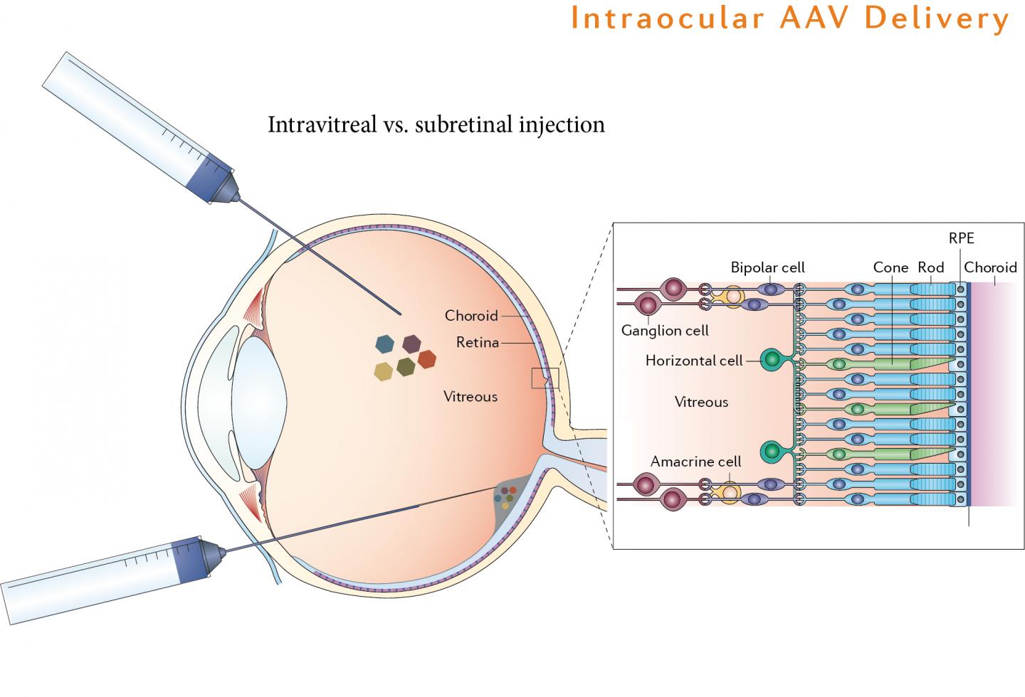 Delivering AAV into the Eye [IMAGE] | EurekAlert! Science News Releases