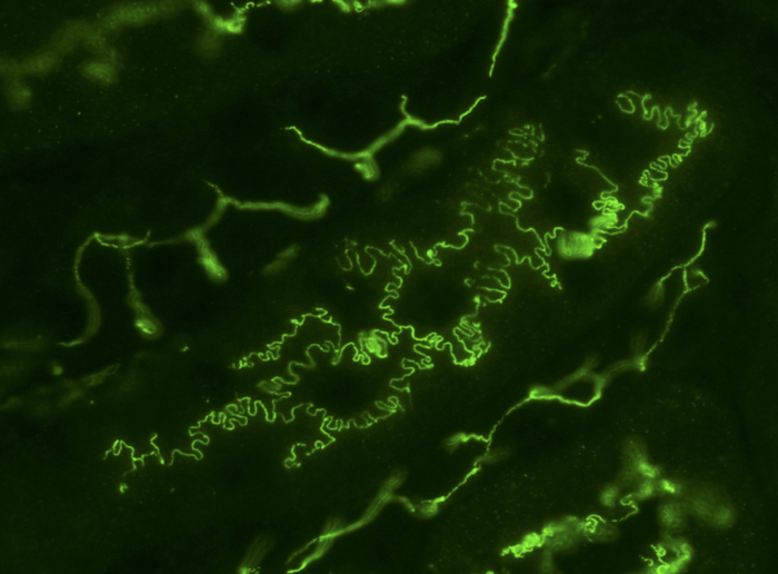 Cell interdigitation [IMAGE] | EurekAlert! Science News Releases