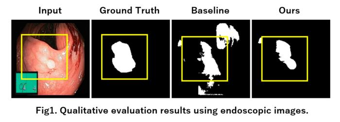 Novel dice loss functions for improved image | EurekAlert!