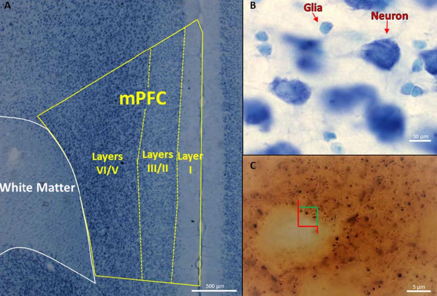 Plastic chemical linked to smaller prefrontal | EurekAlert!