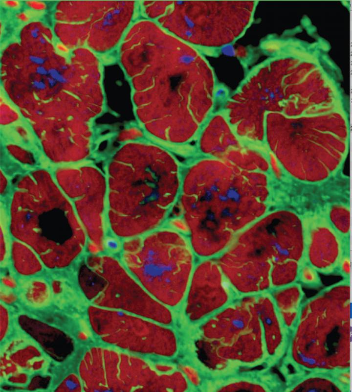 iPS-derived Cardiomyocytes [IMAGE] | EurekAlert! Science News Releases