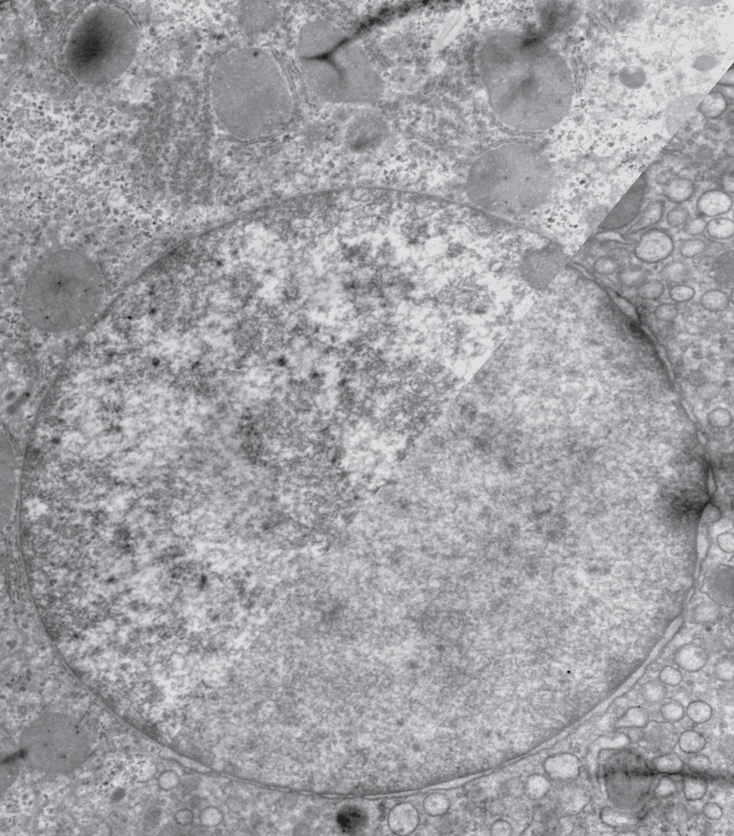 Split Cell [IMAGE] | EurekAlert! Science News Releases