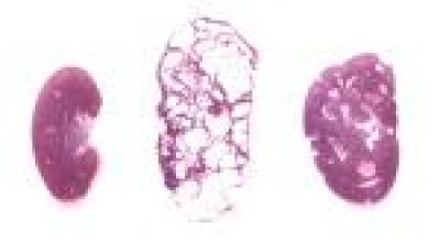 Kidneys [IMAGE] | EurekAlert! Science News Releases