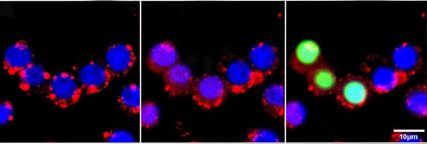 Death of Brain Cancer Cells af [IMAGE] | EurekAlert! Science News Releases