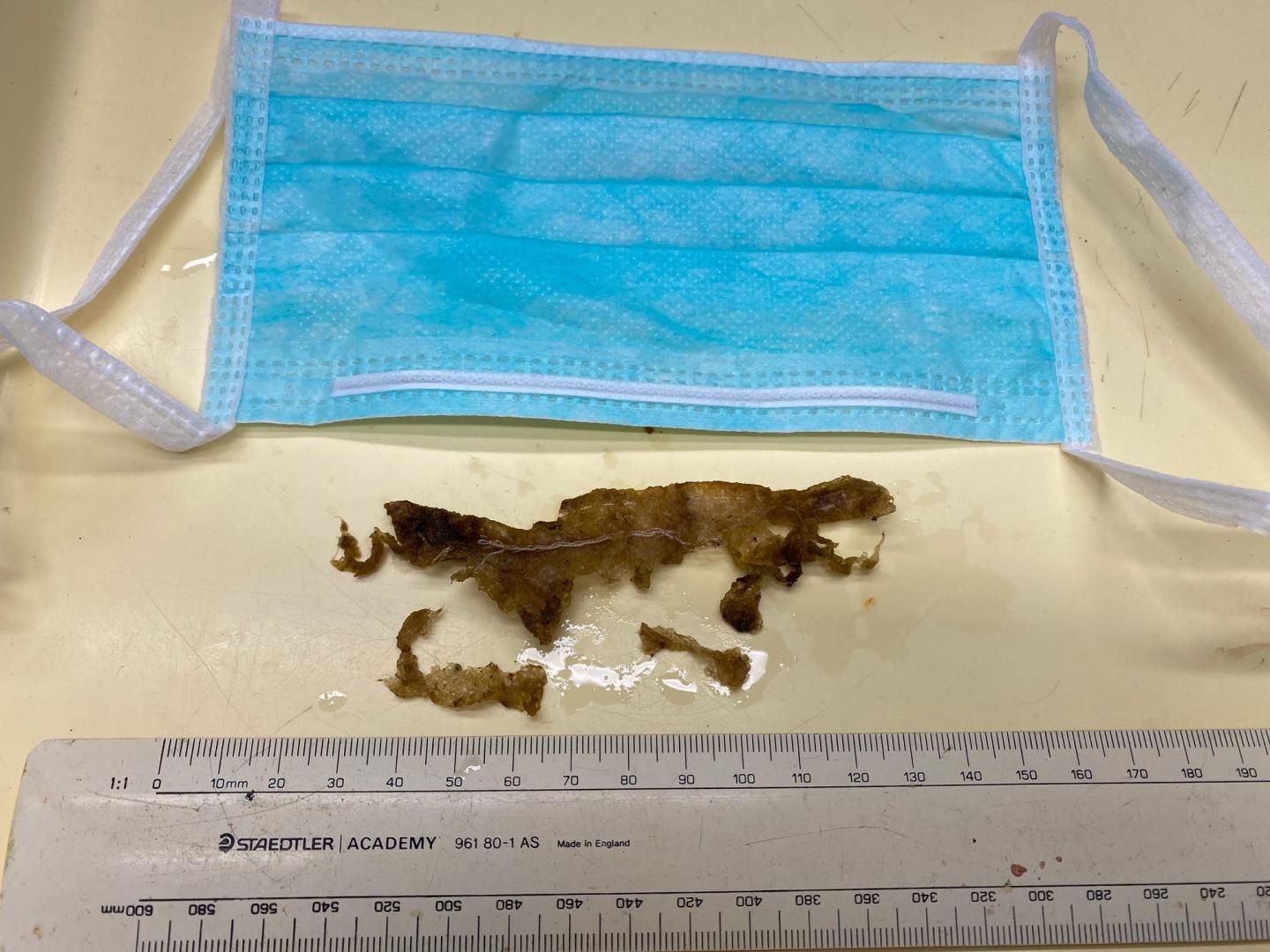 The stomach contents of a Gree [IMAGE] | EurekAlert! Science News Releases