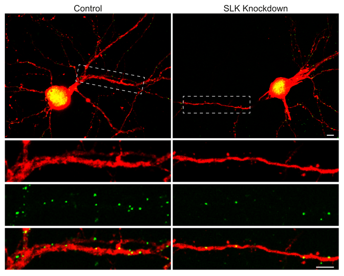 How neurons regulate their excitability auton | EurekAlert!