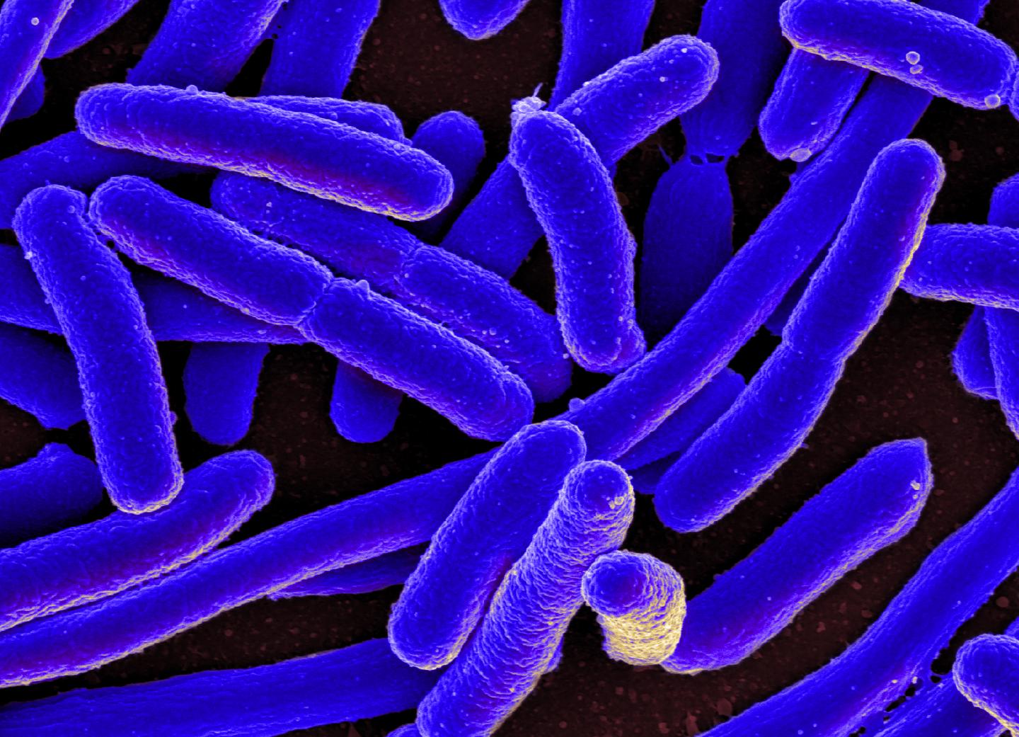 E Coli Bacteria IMAGE EurekAlert Science News Releases
