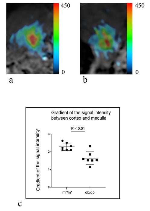 Kidney sodium magnetic resonan [IMAGE] | EurekAlert! Science News Releases