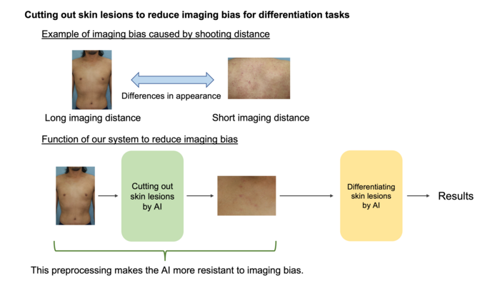 AI model helps atopic dermatitis patients dia | EurekAlert!