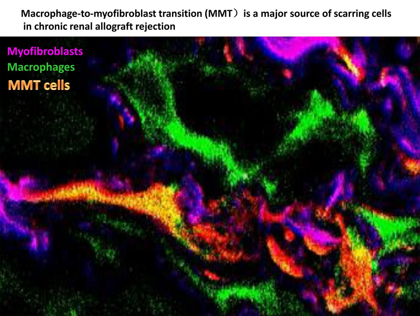 Macrophage-to-Myofibroblast Tr [IMAGE] | EurekAlert! Science News Releases