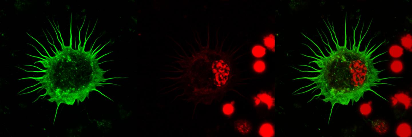 Brain Cells [IMAGE] | EurekAlert! Science News Releases