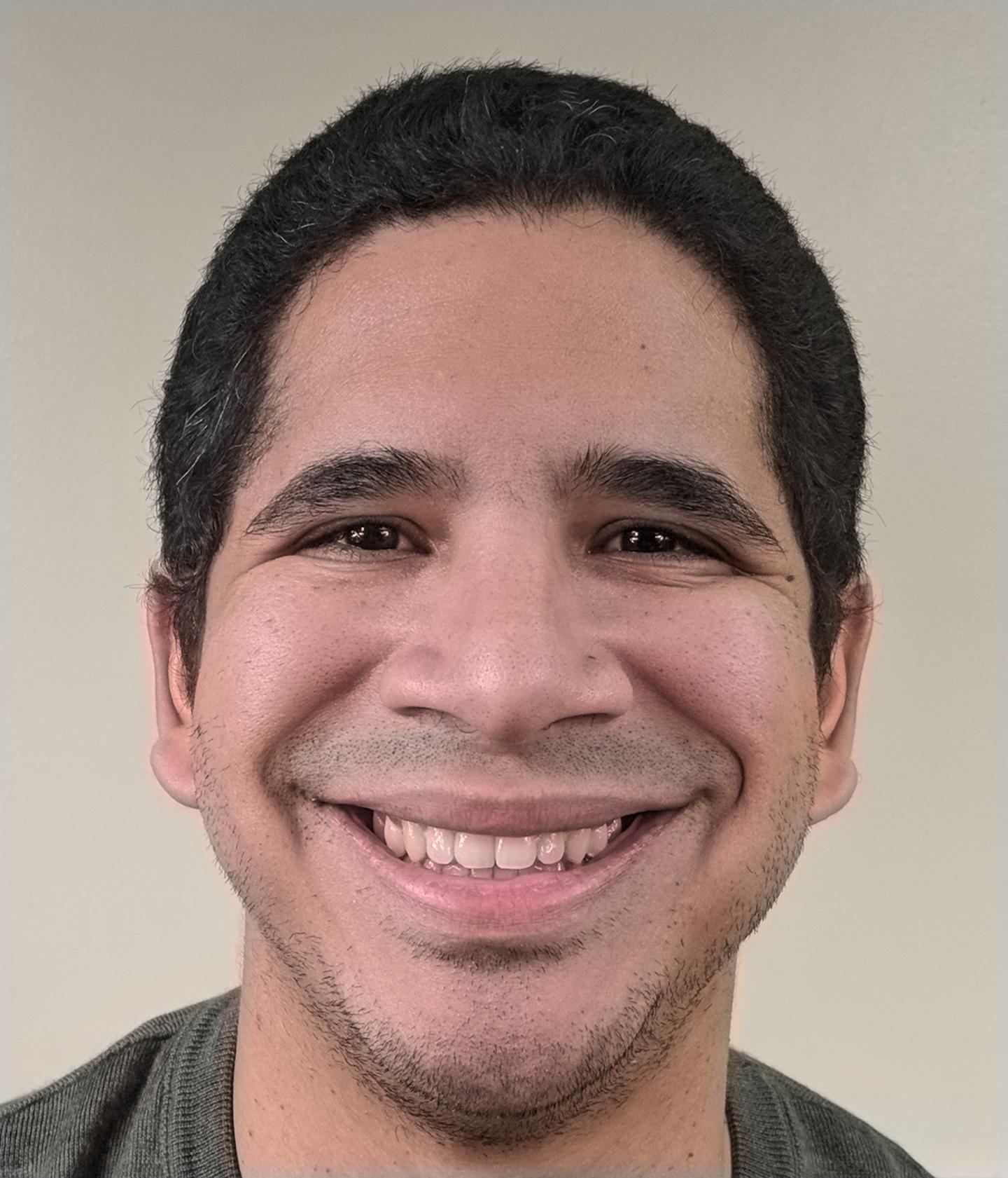 Unphotoshopped Model Face