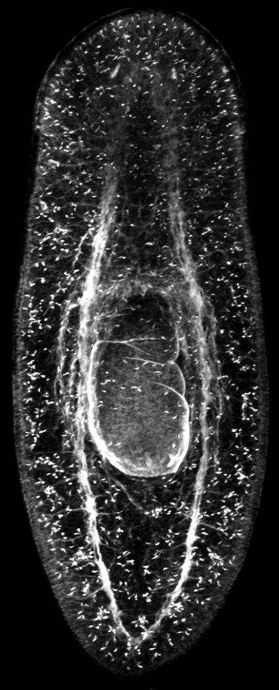 Protonephridia [IMAGE] | EurekAlert! Science News Releases