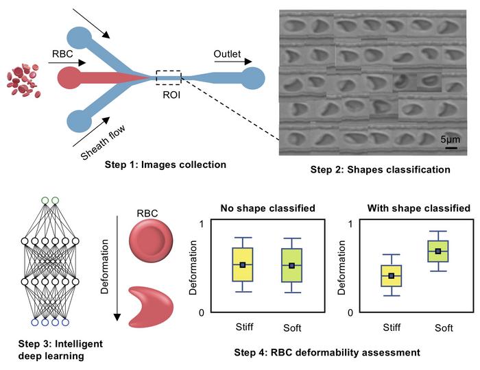 Shaping up how red blood cell deformability i | EurekAlert!
