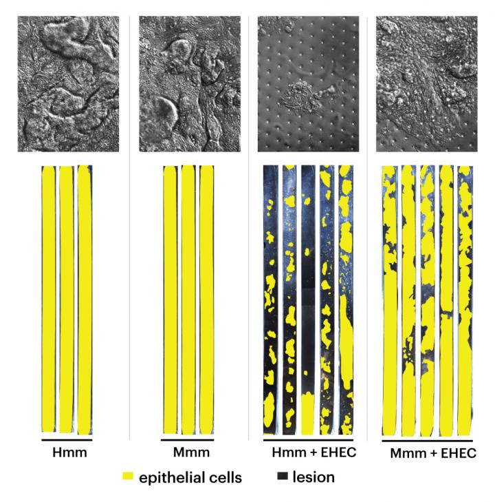 Enterohemorrhagic Ecoli Pathog [IMAGE] | EurekAlert! Science News Releases