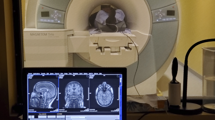 MRI Scan [IMAGE] | EurekAlert! Science News Releases