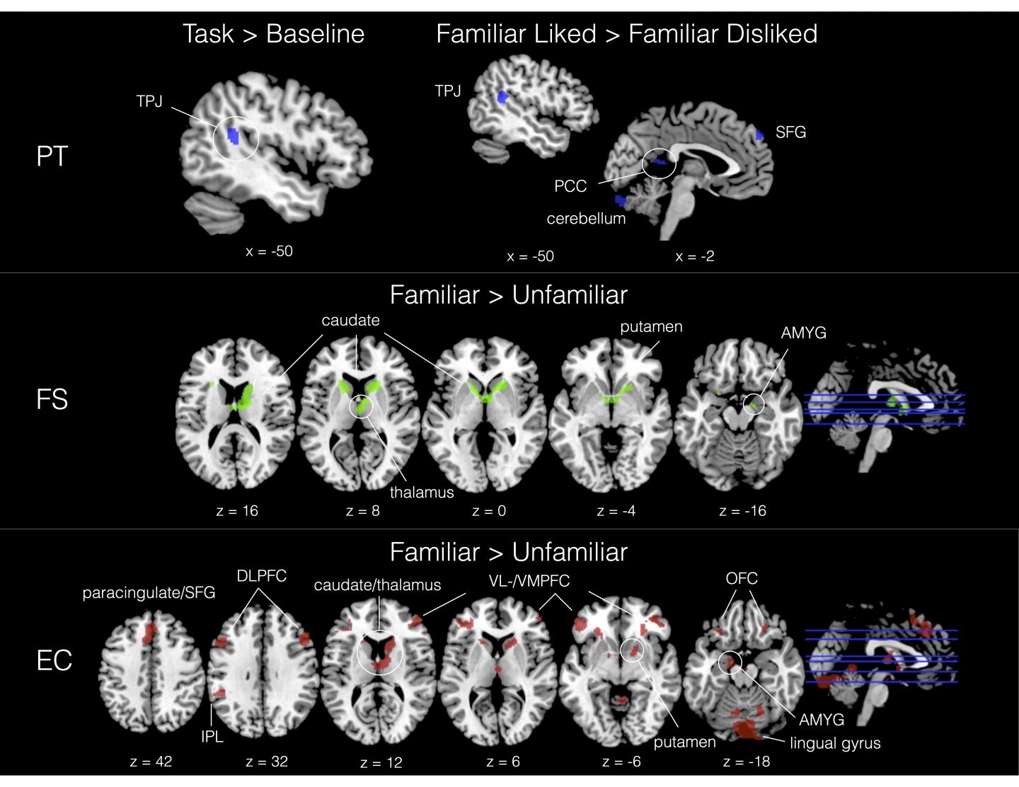 Brains Unique in How they Acti [IMAGE] | EurekAlert! Science News Releases
