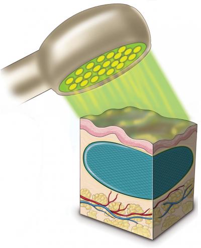 Light-Activated Facial Tissue Implants (3 of | EurekAlert!