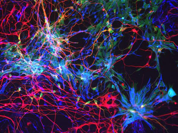 Human Cortical Cells [IMAGE] | EurekAlert! Science News Releases