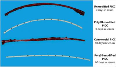 Stopping Infection & Blood Clots in Venous Ca | EurekAlert!