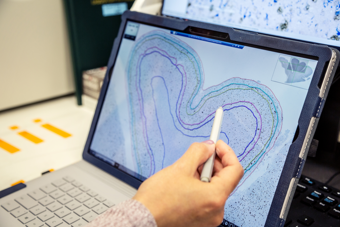 Neuropath Imaging [IMAGE] | EurekAlert! Science News Releases