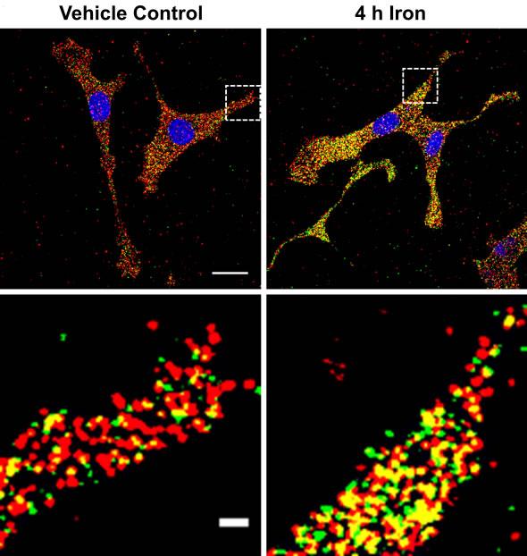 Imaging mRNA right where it is made -- at the | EurekAlert!