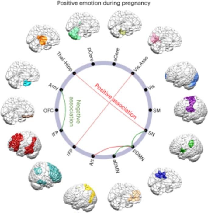 Functional connectivity in rel [IMAGE] | EurekAlert! Science News Releases