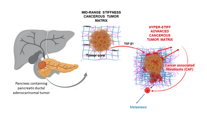 Advanced pancreatic cancer model for developi | EurekAlert!