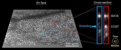 A first glimpse into disc shedding in the hum | EurekAlert!