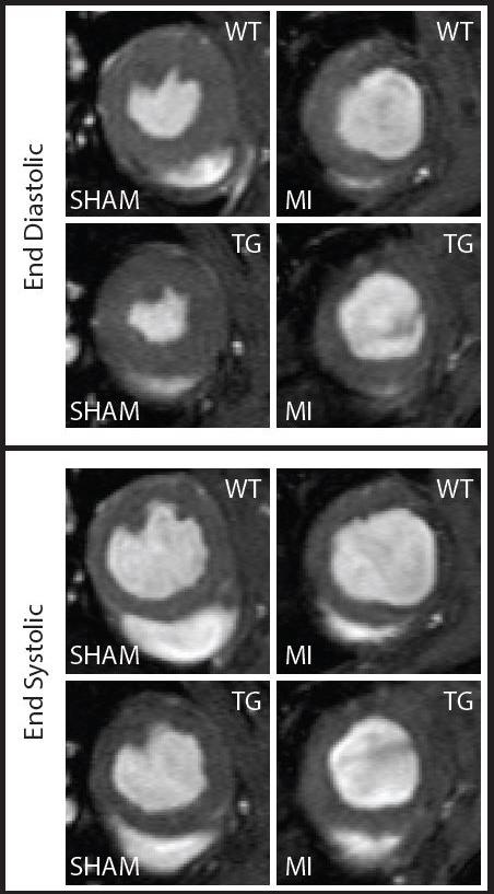 Helping Failing Hearts Act More Grown-Up Coul | EurekAlert!