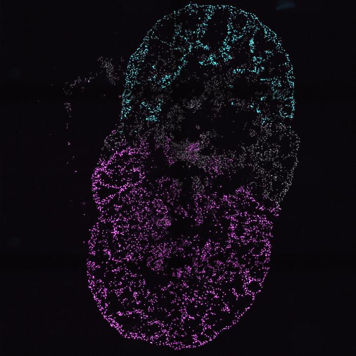 First multi-chamber heart organoids unravel h | EurekAlert!